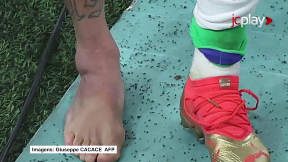 NEYMAR MACHUCADO? O que aconteceu com NEYMAR? Neymar vai jogar na COPA ... NEYMAR MACHUCADO? O que aconteceu com NEYMAR? Neymar vai jogar na COPA ...