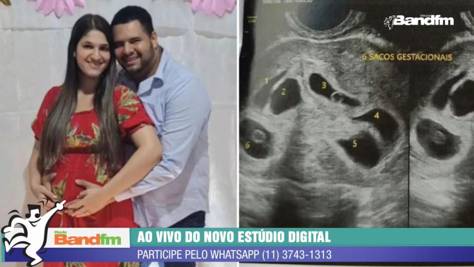 Mulher Faz Ultrassom E Descobre Que Está Grávida De Sêxtuplos Vídeos Band